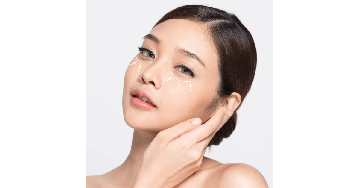 Illumia Medical Singapore: Best Skin & Hair Treatments